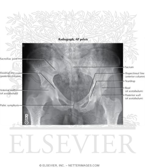 Radiology of the Pelvis