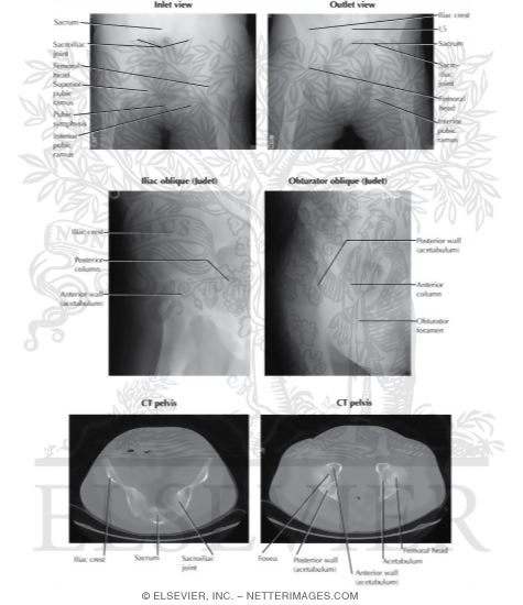 Radiology of the Pelvis