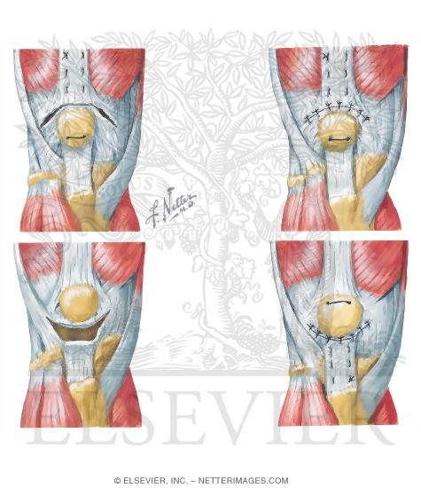 Disorders of the Leg and Knee