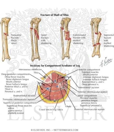 Knee Trauma Symptoms