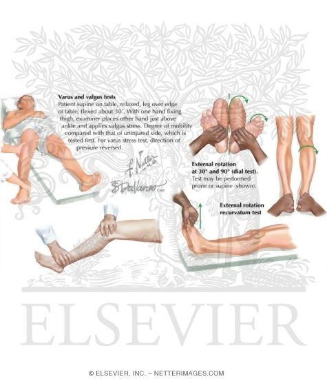 Physical Examination of the Leg and Knee