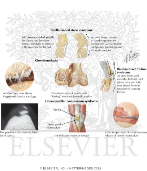 Disorders of the Leg and Knee