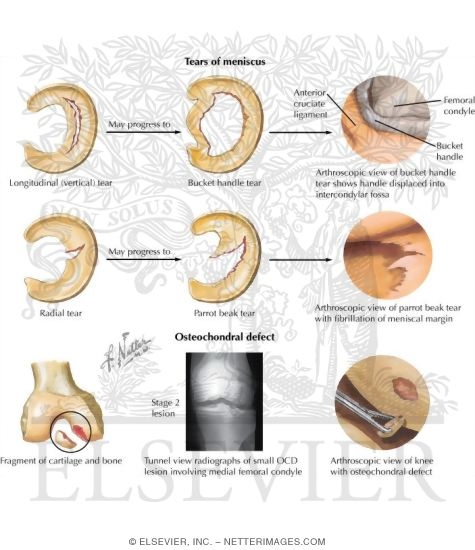 Disorders of the Leg and Knee