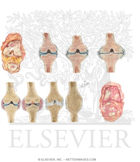 Disorders of the Leg and Knee