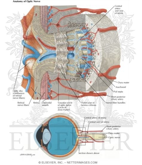Glaucoma