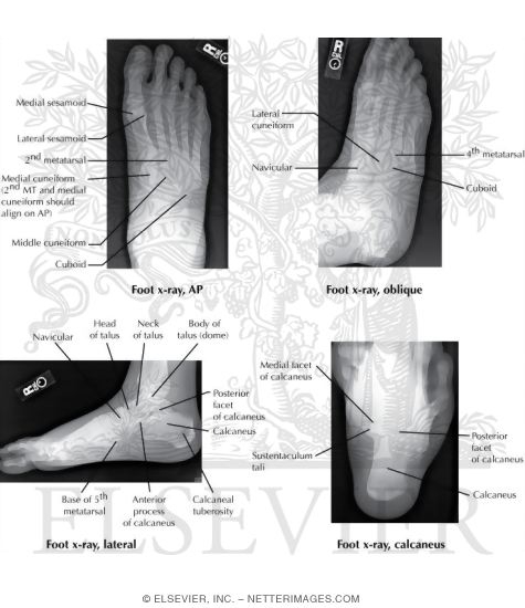 Radiology of the Foot and Ankle