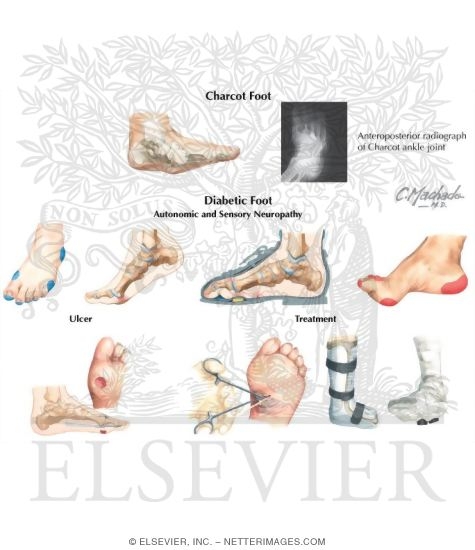 Watermarked preview of labeled image: Disorders of the Foot and Ankle