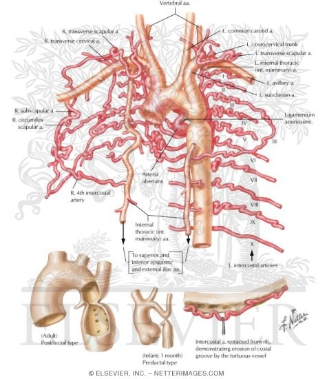 Anomalies of the Aortic-Arch System Anatomic Features of Aortic ...