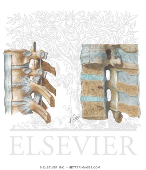 Joints of the Vertebral Arches and Bodies