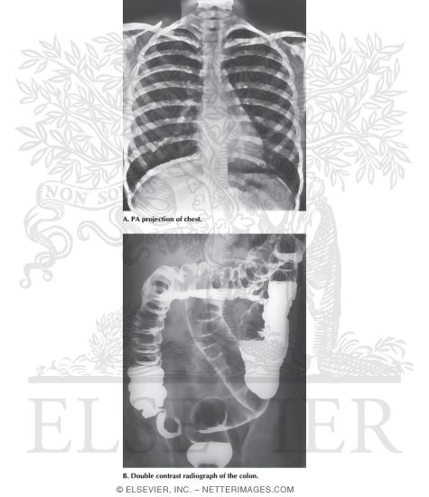 Plain (Conventional) Radiographs
