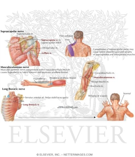 Neuropathy About Shoulder