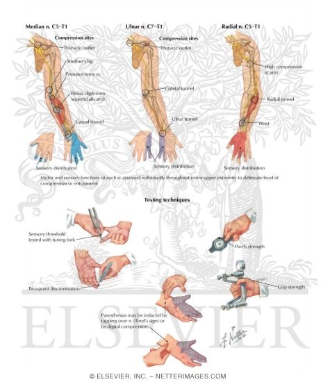 Clinical Evaluation of Compression Neuropathy
