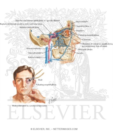 Cavernous Sinus Netter