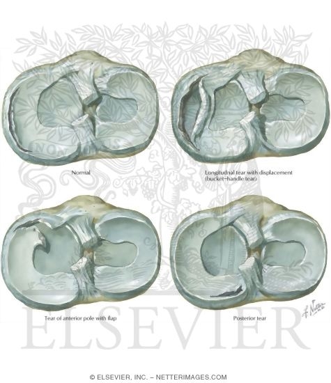 Disorders of the Knee