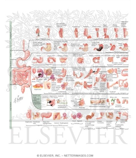 Alimentary Tract Obstruction