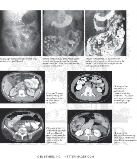 Imaging Studies of the Small Intestine