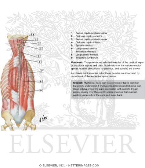 Erector Spinae Trigger Points