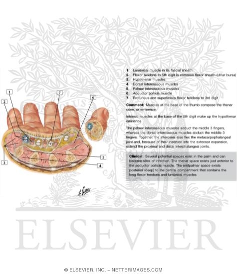 Spaces, Bursae, and Tendon and Lumbrical Sheaths of Hand Bursae, Spaces ...