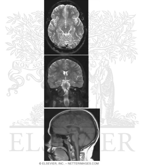 Cranial Imaging (MRI)