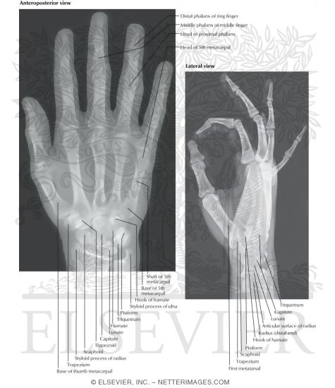 Wrist and Hand: Radiographs