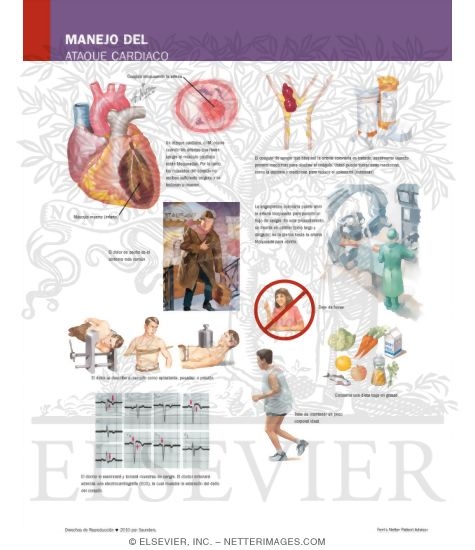 Managing Your Heart Attack