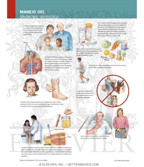 Managing Your Nephrotic Syndrome