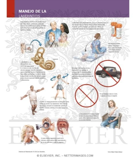 Managing Your Labyrinthitis