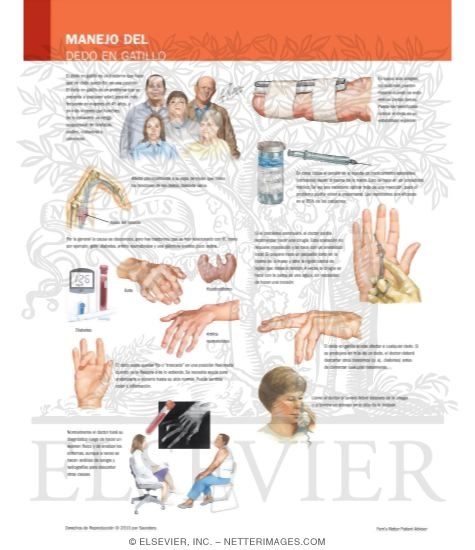 Managing Your Trigger Finger