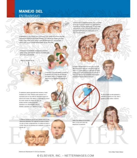 Managing Your Strabismus