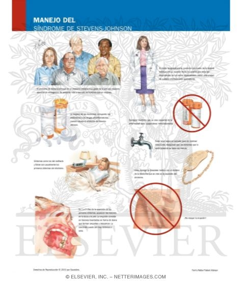 Managing Your Stevens-Johnson Syndrome