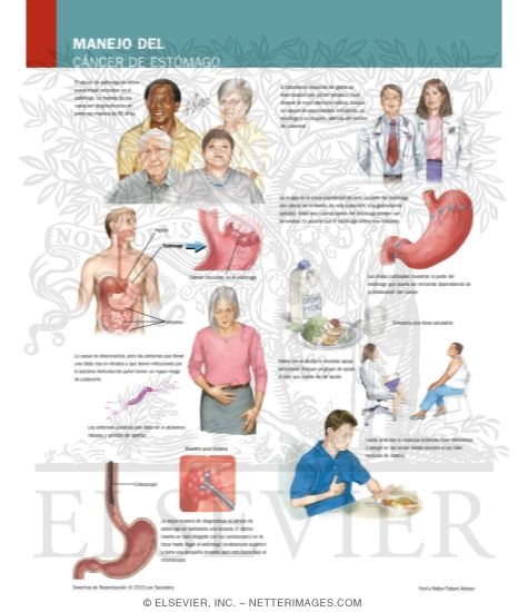 Managing Your Stomach Cancer