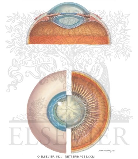 Cataracts Anterior Segment of Eye
