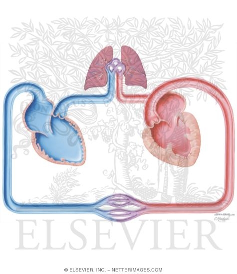 Congestive Heart Failure; Schematic #3