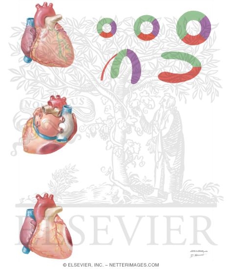 Spect Perfusion Studies In Coronary Artery Disease