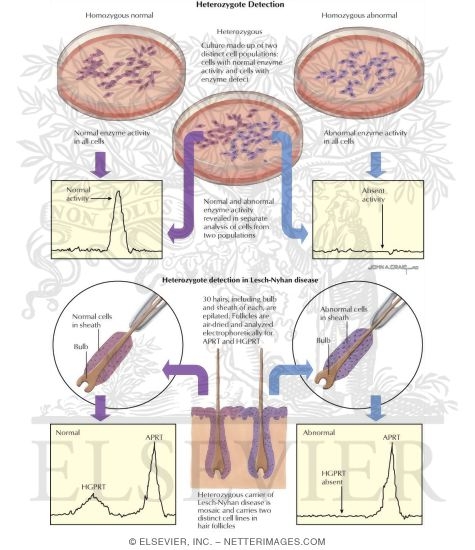 Birth Defects: Heterozygote Detections