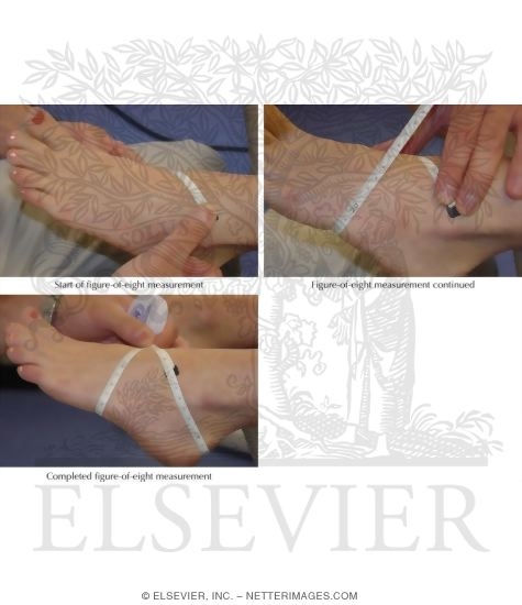 Figure-of-Eight Measurement