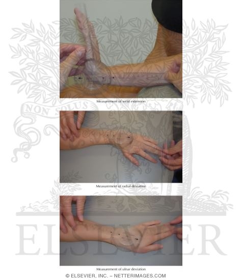 Wrist Range of Motion