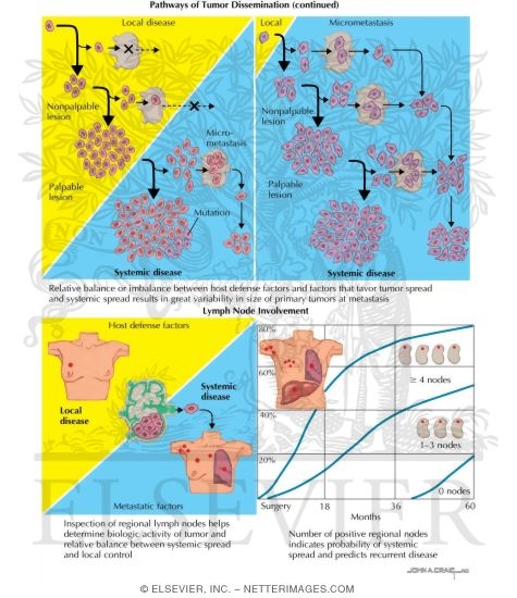 Pathways of Tumor Dissemination