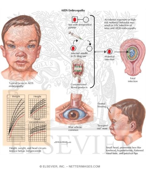 embryopathy - meddic