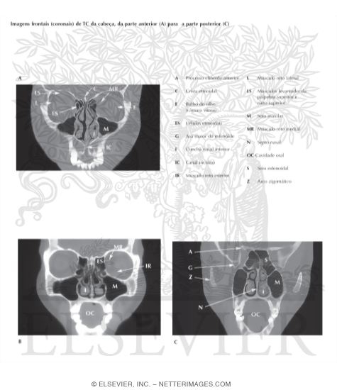 Head Scans: Coronal CT Images