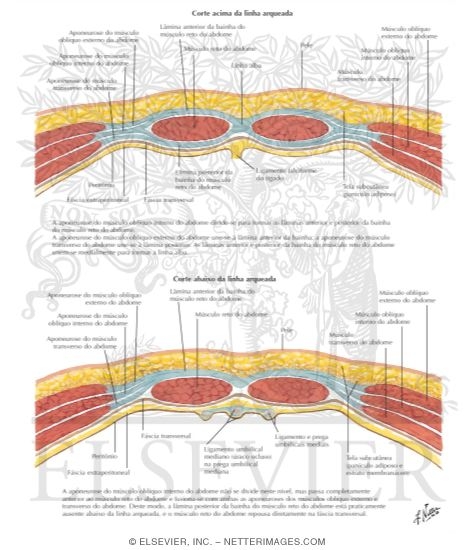 Rectus Sheath: Cross Sections