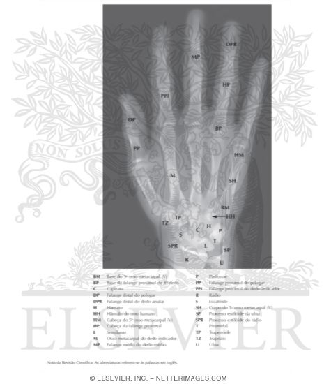 Wrist and Hand: Anteroposterior Radiograph