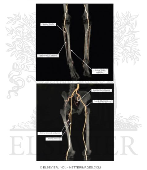 CT Angiograms of Arteries of the Lower Limb