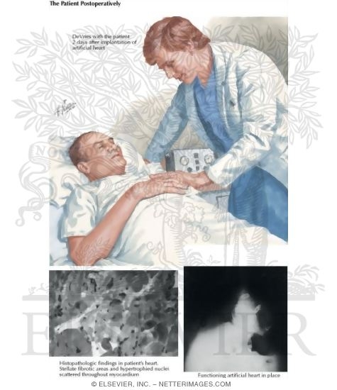 The Patient Postoperatively