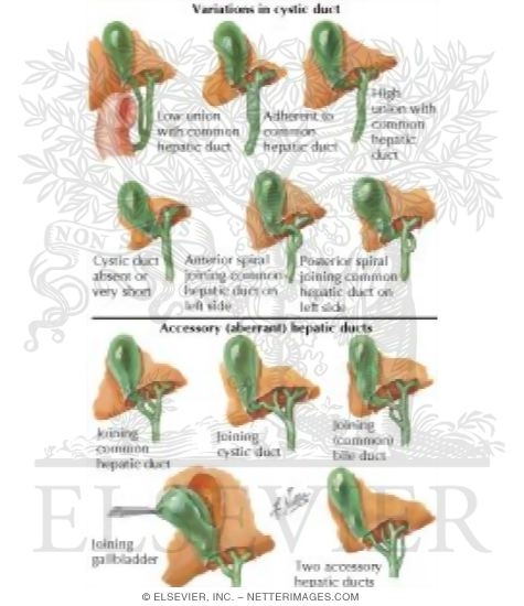 Variations In Cystic and Hepatic Ducts