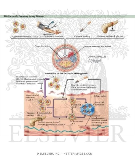 Risk Factors in Coronary Heart Disease