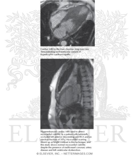 Cardiac Magnetic Resonance Imaging (MRI)