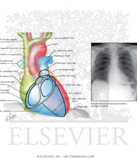 Radiology and Angiocardiography