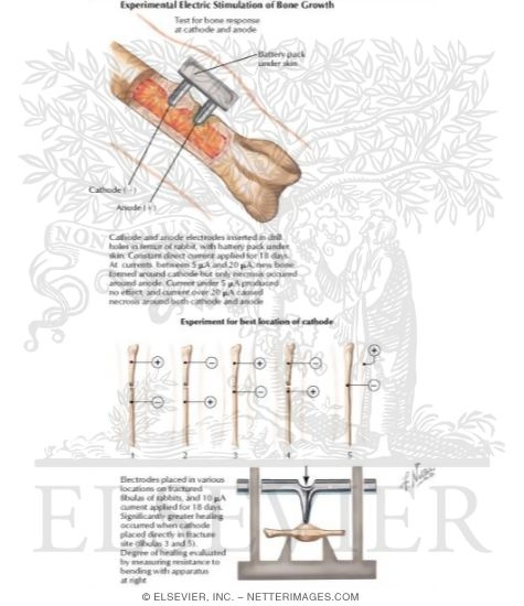 Experimental Electric Stimulation of Bone Growth