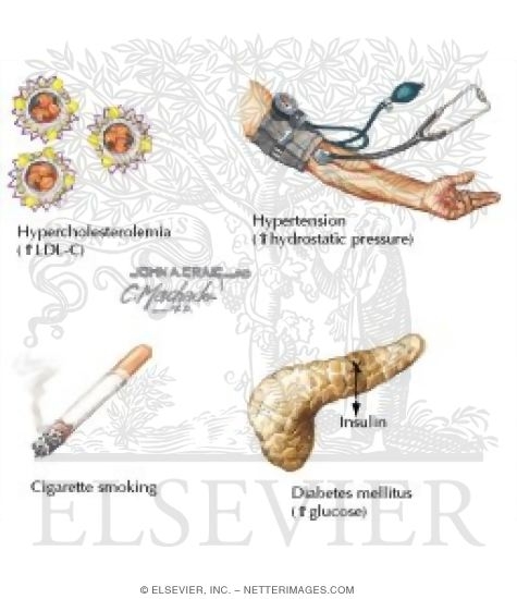 Risk Factors In Coronary Heart Disease